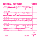 1984 Pontiac Fiero, IC Circuit Waveform - iATN