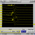 1997 Ford F-250, Ignition - Secondary Waveform - iATN