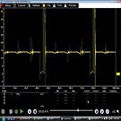 1998 Ford F-150 Lariat, Ignition Waveform - iATN