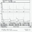 1996 Dodge Neon, Ignition - Secondary Waveform - iATN