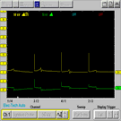 1999 Chevrolet Cavalier, Ignition - Secondary Waveform - iATN