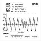 2000 Caterpillar C-12, CMP Sensor Waveform - iATN